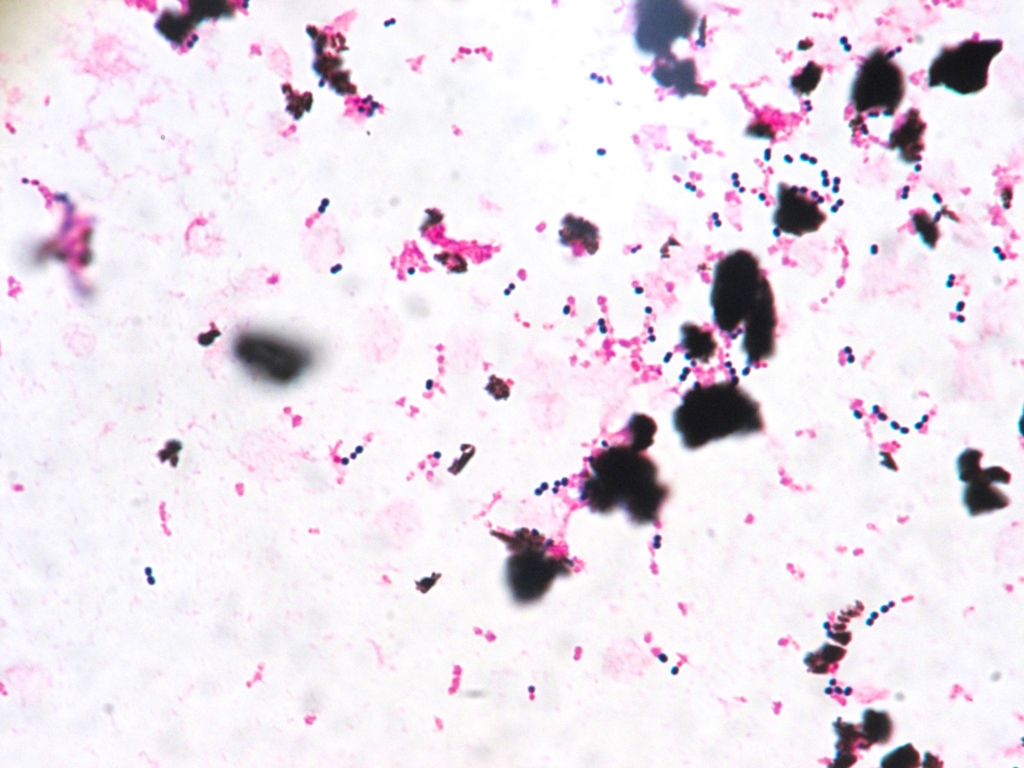 1歳児 ♀ Occult bacteremia | グラム染色: Gram Stain